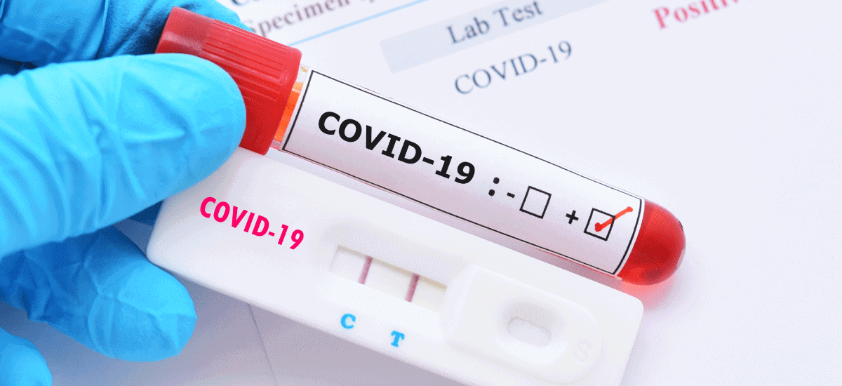 “Different Types Of Tests Used To Detect Coronavirus” – International ...